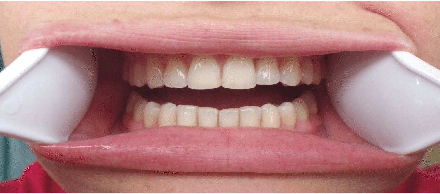 Virtual Consultations - All Smiles Orthodontics