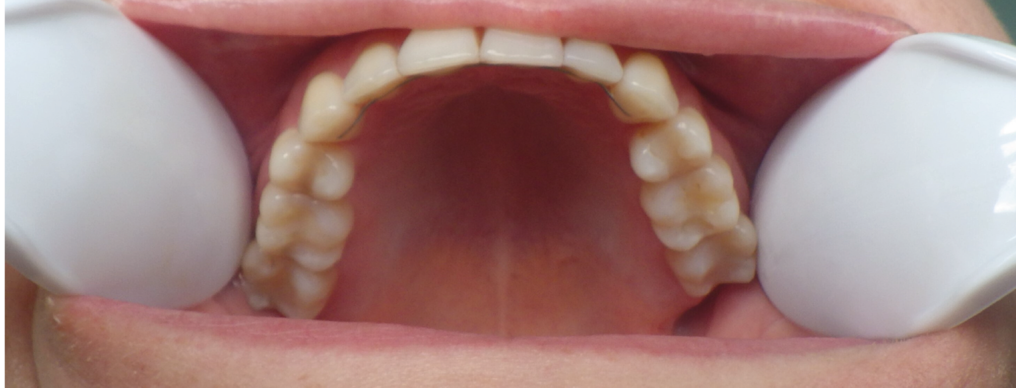 Virtual Visits - All Smiles Orthodontics